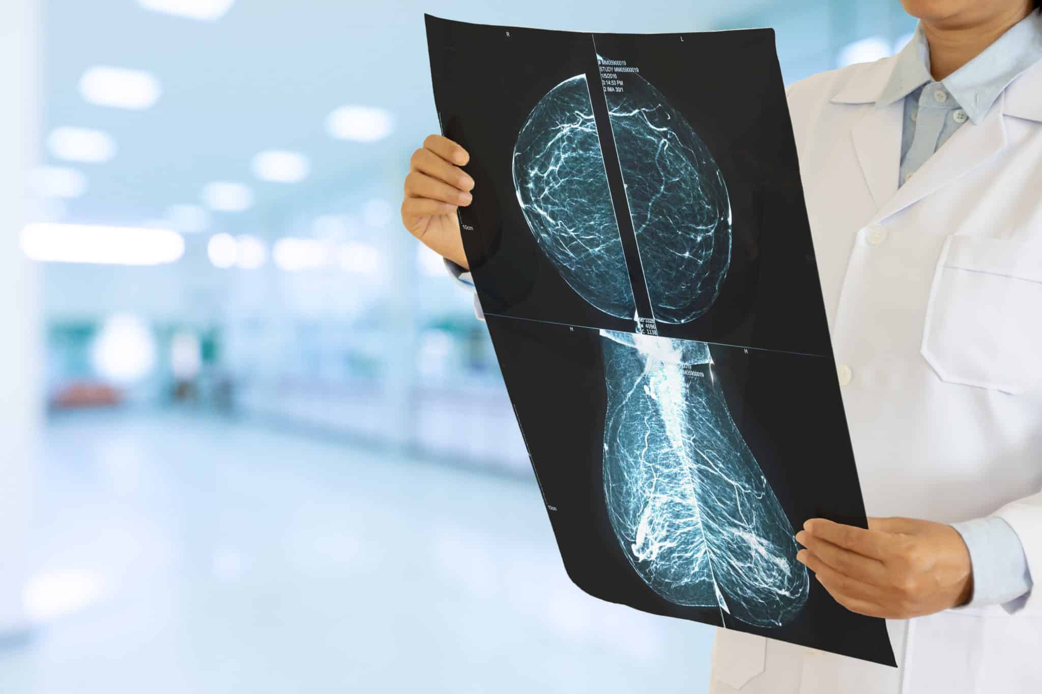 Types of Mammograms | Screening | Diagnostics Lake Grove, NY Types of Mammograms | Screening | Diagnostics Lake Grove, NY